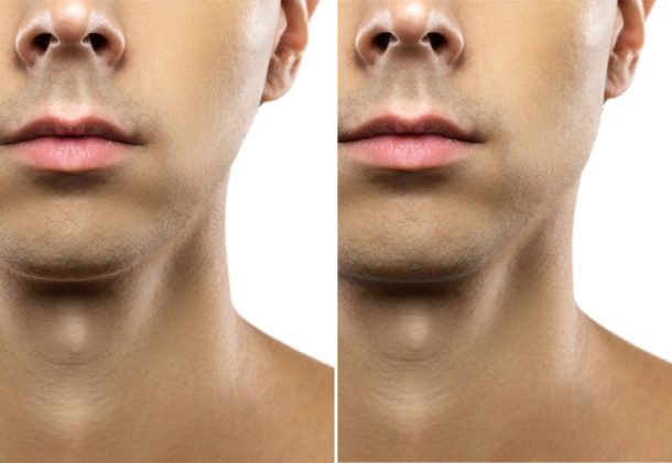 Thumbpulling: Can Your Thumbs Help Shape A Better Jawline? - AmongMen